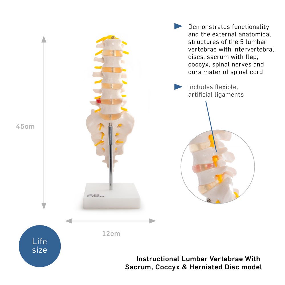 66fit Anatomical Lumbar Vertebrae With Sacrum/Coccyx/Herniated Disc ...